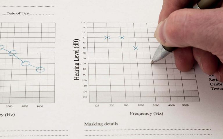 How Do I Read My Hearing Test Results? - Helping Me Hear