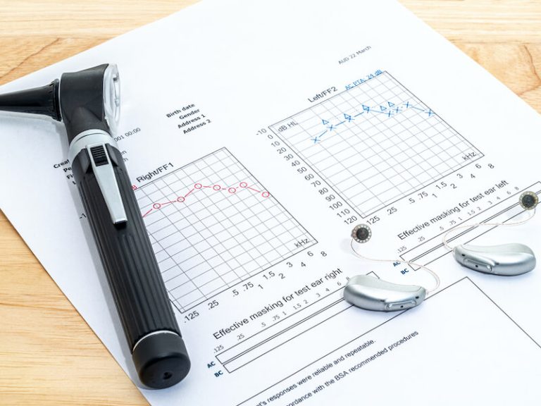 How to Read Your Hearing Test or Audiogram - Helping Me Hear