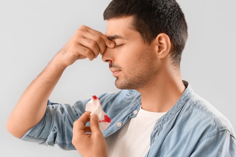 When to See an ENT Specialist for Frequent Nosebleeds - Helping Me Hear