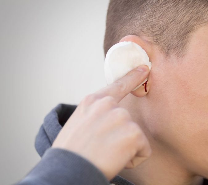 Should I See a Specialist for a Bleeding Ear? - Helping Me Hear